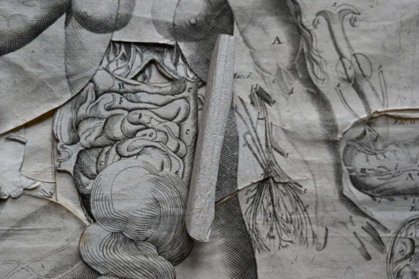 World Anatomy Day - 'dissecting’ an interesting book found in Raby’s ...